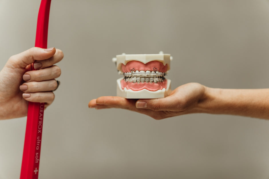 Damon® Fixed Orthodontics | Arch Dentistry